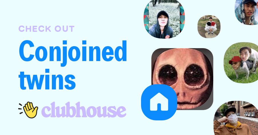 Conjoined twins