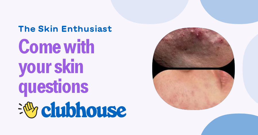 Come with your skin questions